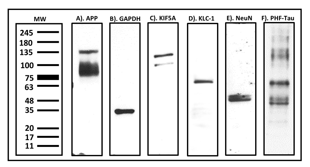 KIF5A and KLC1 expression in... | Health Open Research